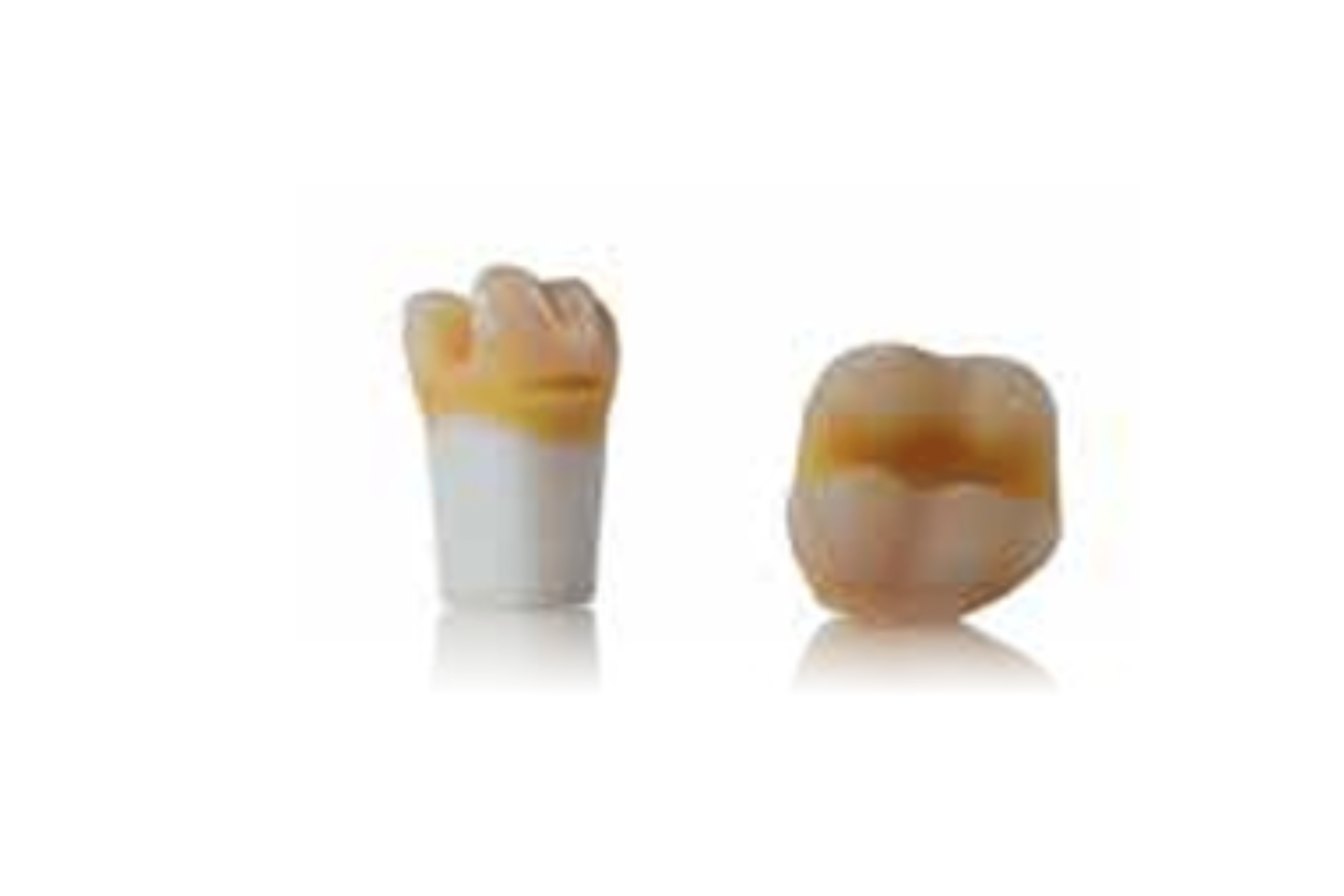 4D træningstænder og uddannelsesmodeller: Tand 36 – Weesgaard Dental.dk