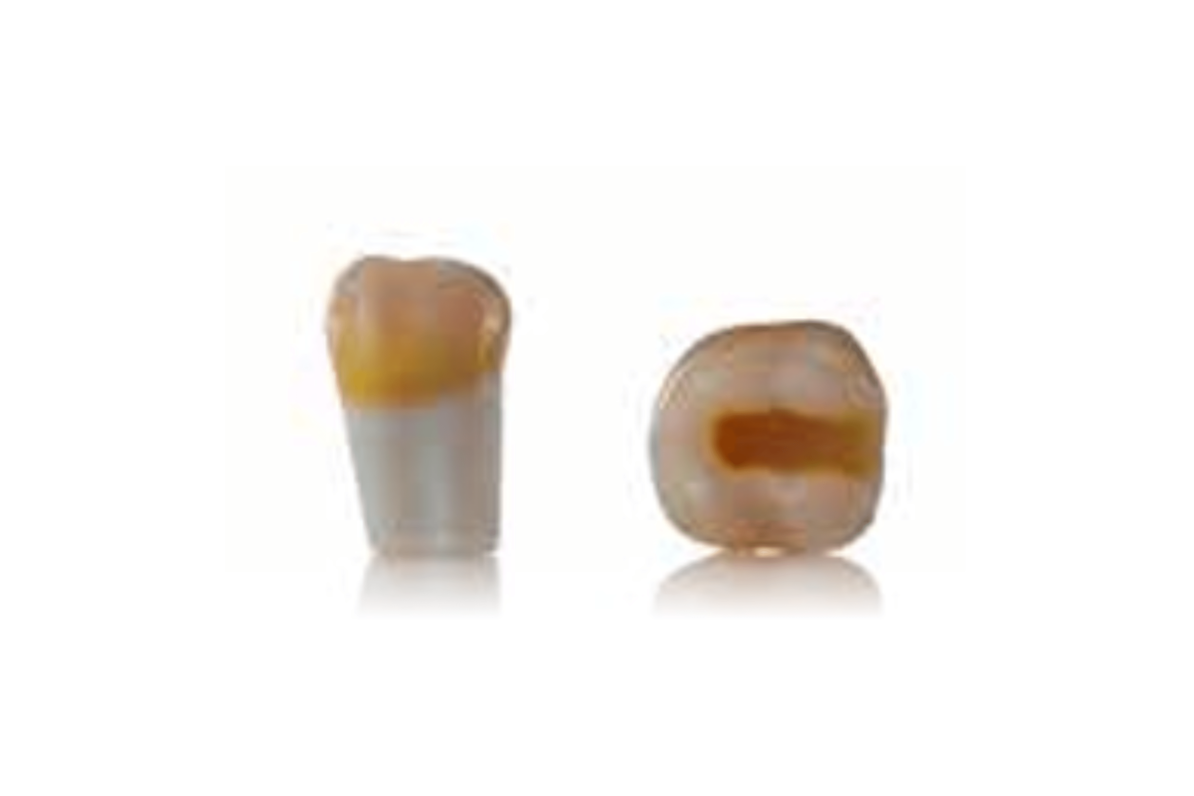 4D trænings-tænd og model: Tand 37 - EFTERÅR 24 – Weesgaard Dental.dk